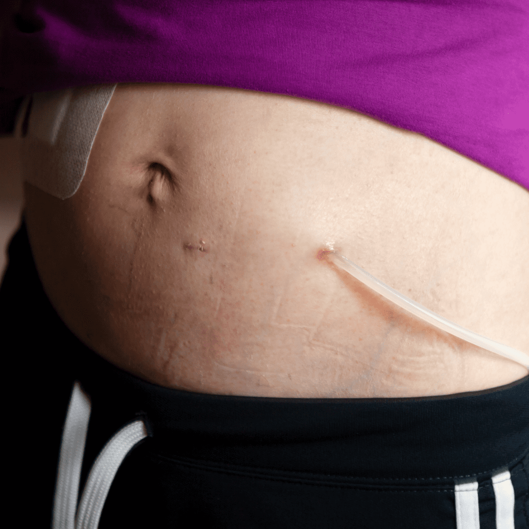 Dra. Jacqueline Menezes – Oncologia | Cirurgiã Oncológica Ginecológica
